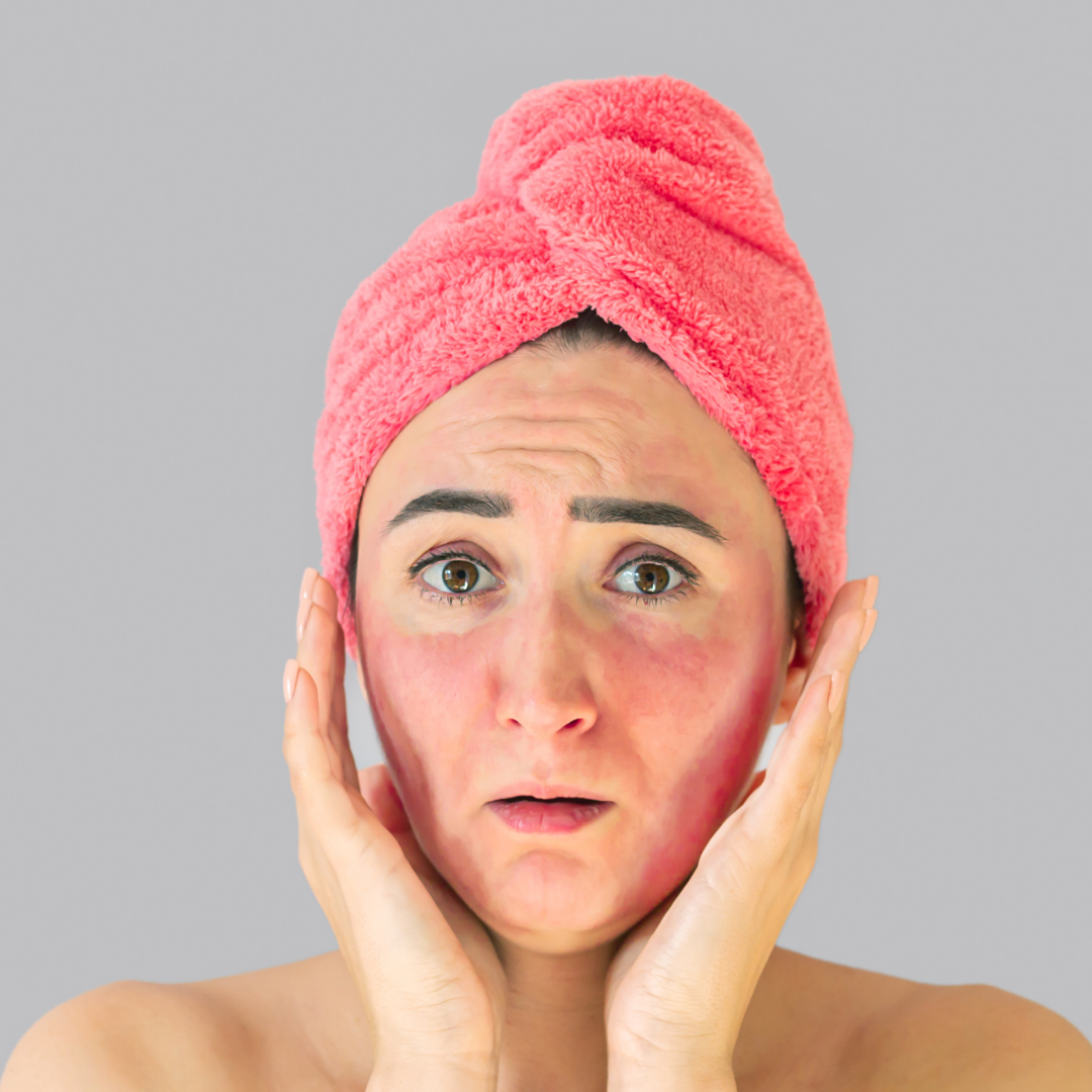 The Link Between Peri-Menopause and Facial Flushing – The Treatment Centre